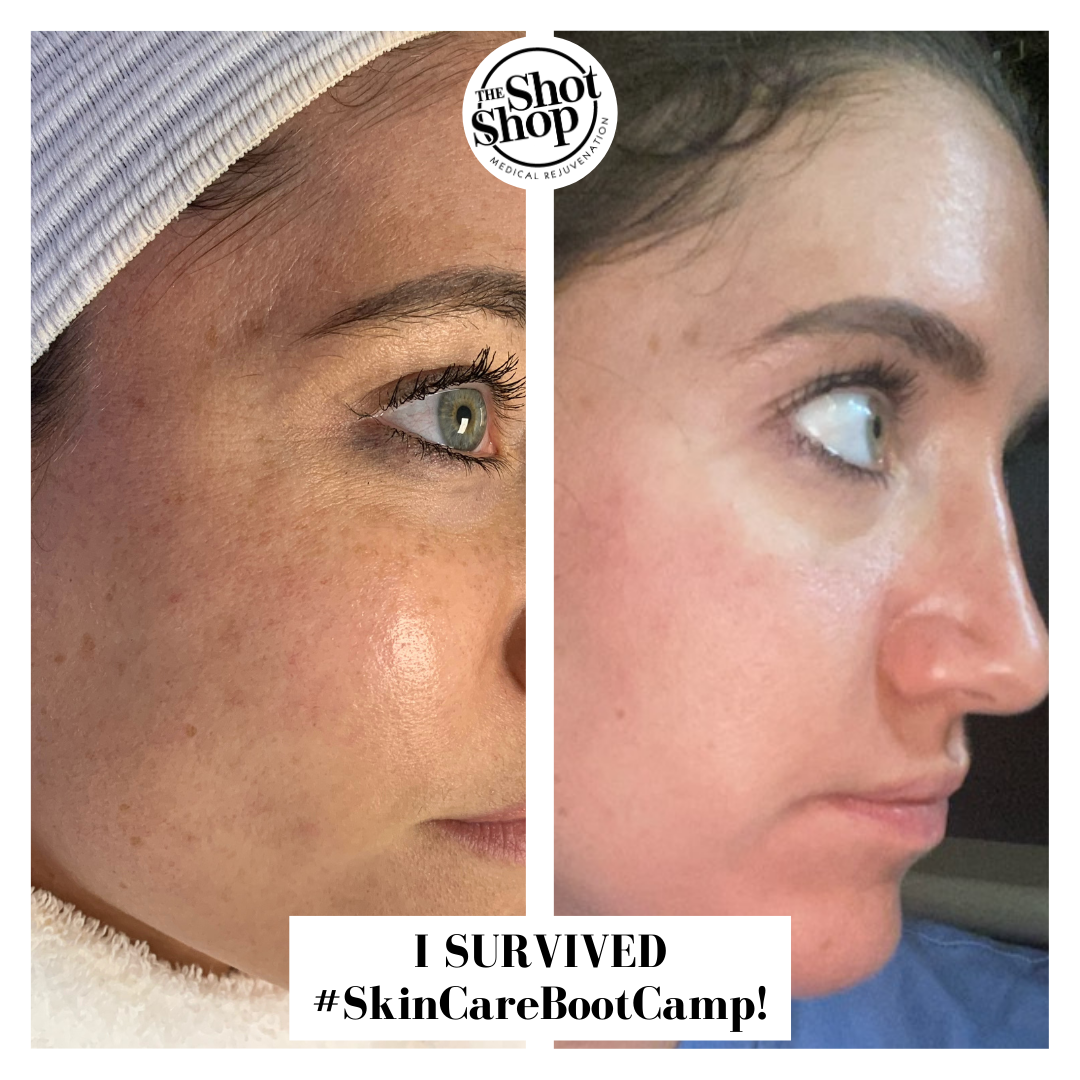 Skincare Boot Camp - Shot Shop Med Spa