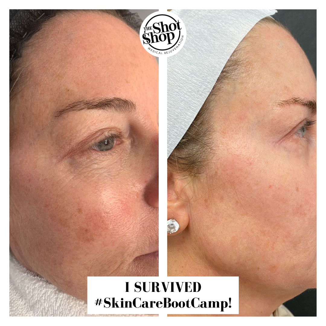 Skincare Boot Camp - Shot Shop Med Spa